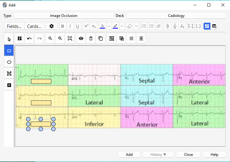 Anki Setup & Use Guide – VitalNotes